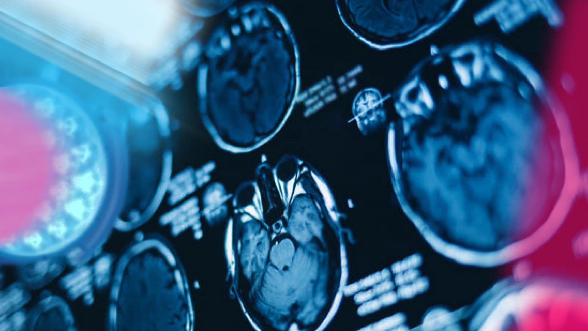 proALPHA: ERP-Software für den Mittelstand | proALPHA